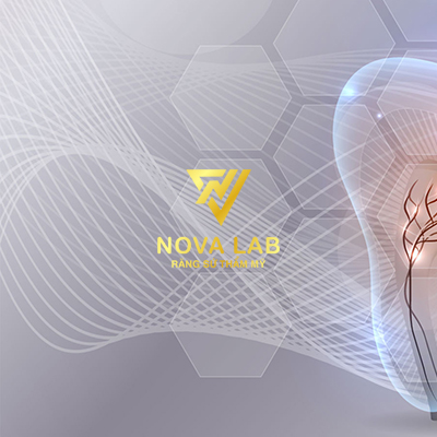 NOVA LAB